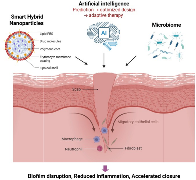 Smart hybrid nanomaterials for chronic infections: microbiome ...