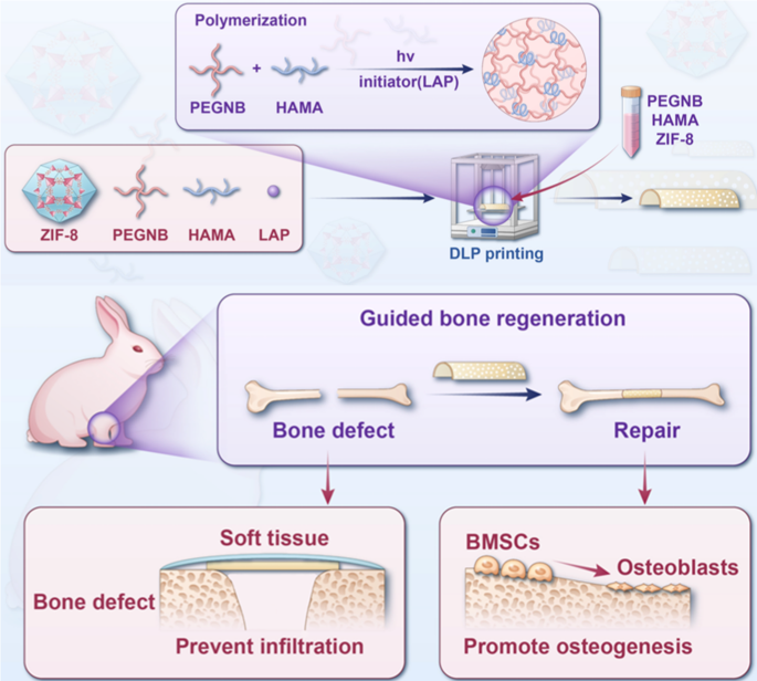 Shape-fit 3D printed mineralized membrane for guided bone regeneration ...