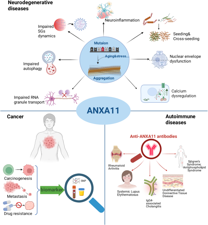 Physiological and pathological roles of ANXA11: a multifunctional ...