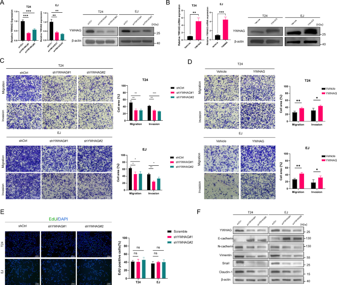 YWHAG promotes bladder cancer metastasis by regulating TMOD3 to ...