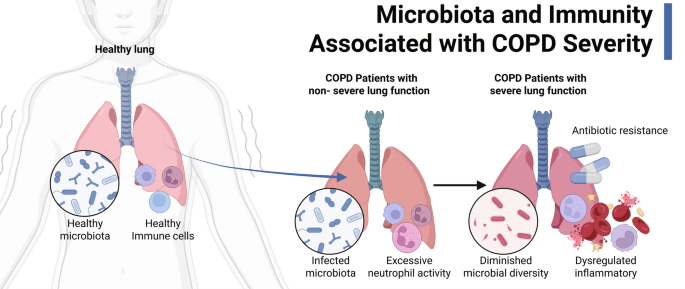 Airway microbiota and immunity associated with chronic obstructive ...