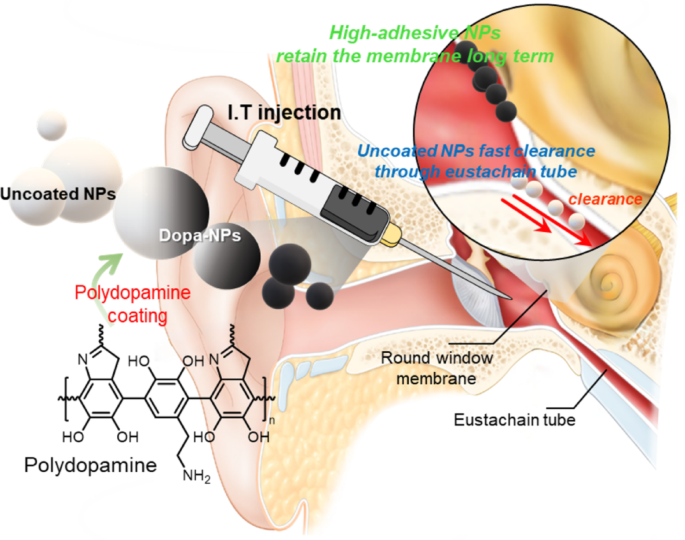 Mucoadhesive polydopamine-coated nanoparticle-mediated inner ear drug ...