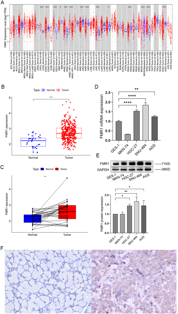 Fragile X mental retardation 1 gene FMR1 promotes proliferation ...