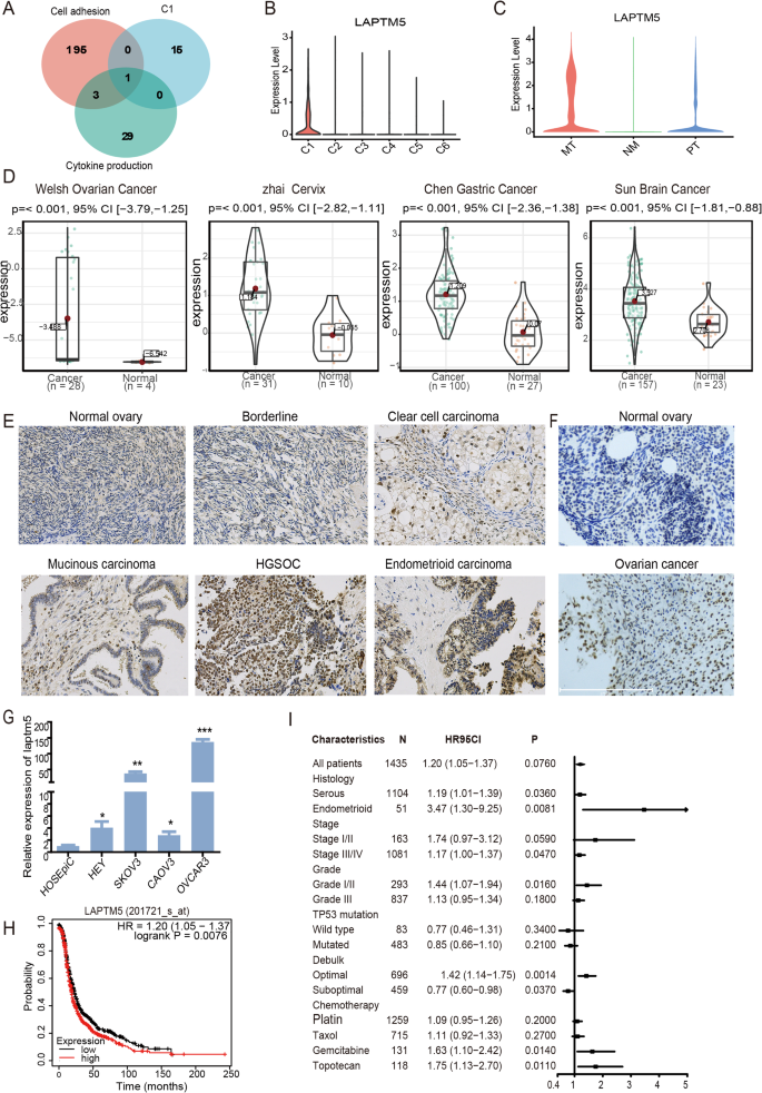 LAPTM5 drives omental metastasis in high-grade serous ovarian cancer ...