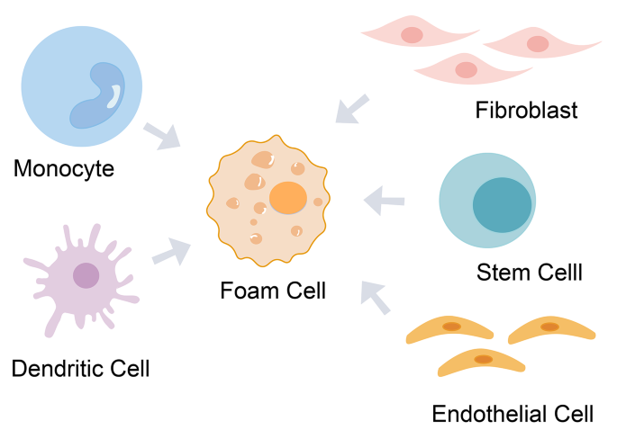 Foam cells: tracing the diverse cellular origins and their linked ...