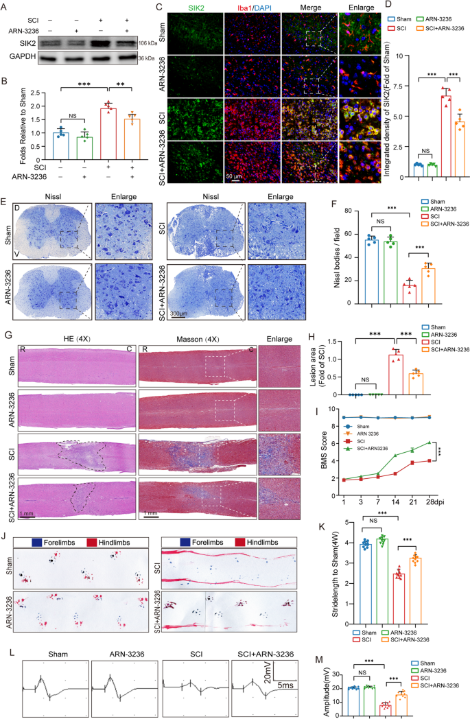 SIK2 mediated mitochondrial homeostasis in spinal cord injury ...