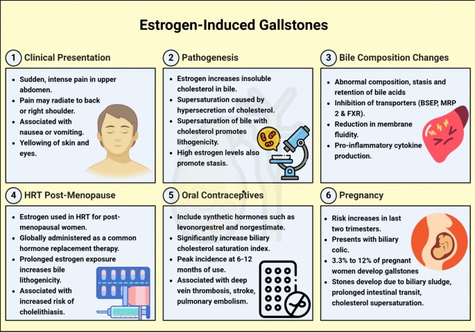 The estrogen-gallstone connection: uncovering the pathways | Discover ...