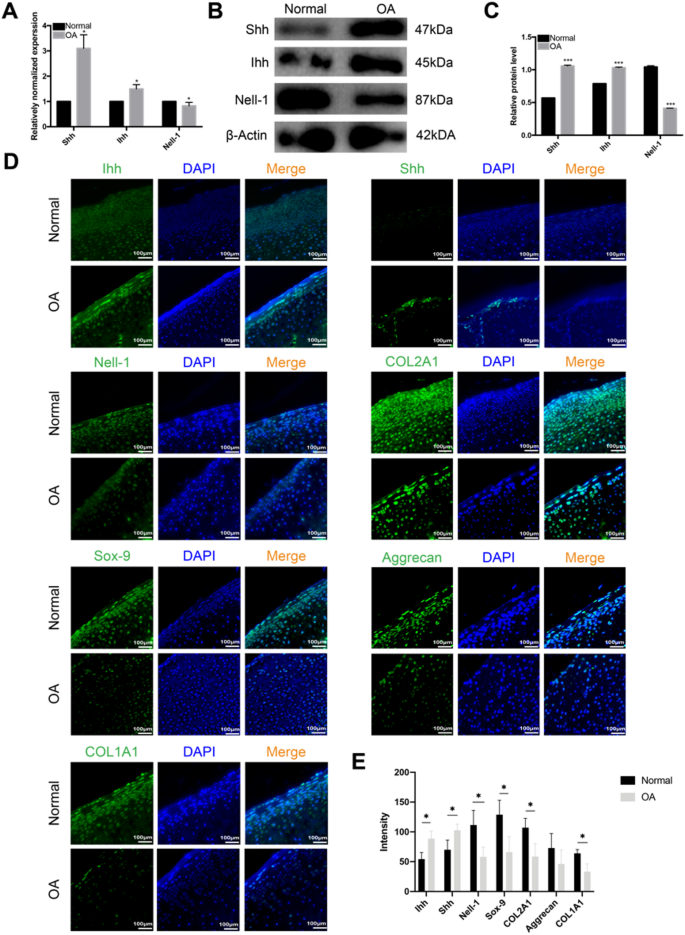 Nell-1 regulates fibrocartilage stem cells and alleviates ...