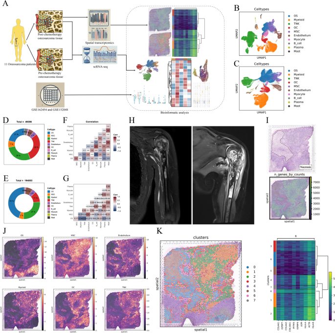 A single-cell and spatially resolved atlas of human osteosarcomas ...