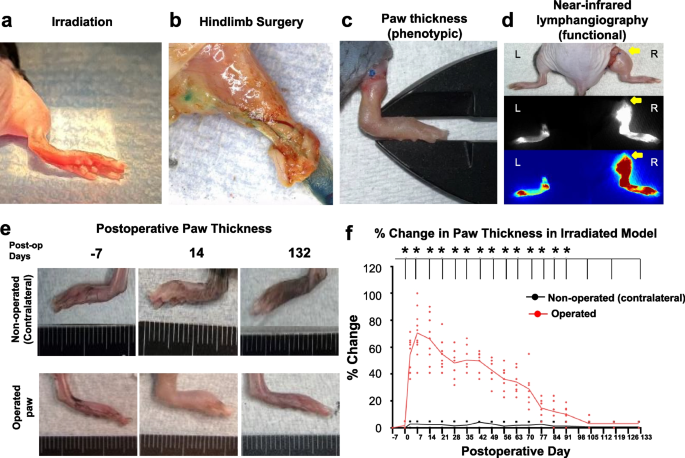 Murine hindlimb lymphedema model: optimization and evaluation of ...