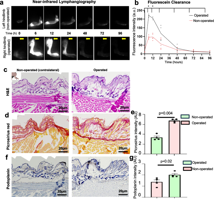 Murine hindlimb lymphedema model: optimization and evaluation of ...