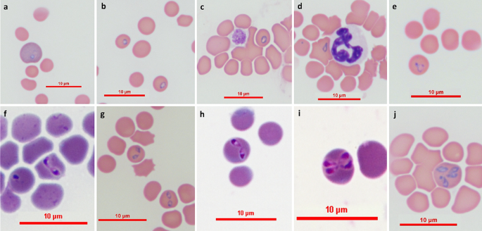 Description of Babesia galileei sp. nov. A piroplasmid species causing ...