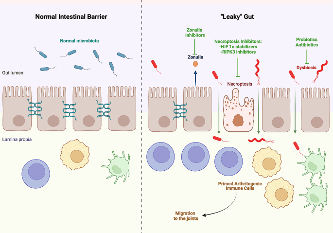 Stabilizing the integrity of intestinal barrier to control arthritis ...
