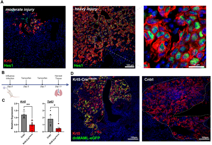 Examining the role of Notch signaling in dysplastic lung repair | BMC ...