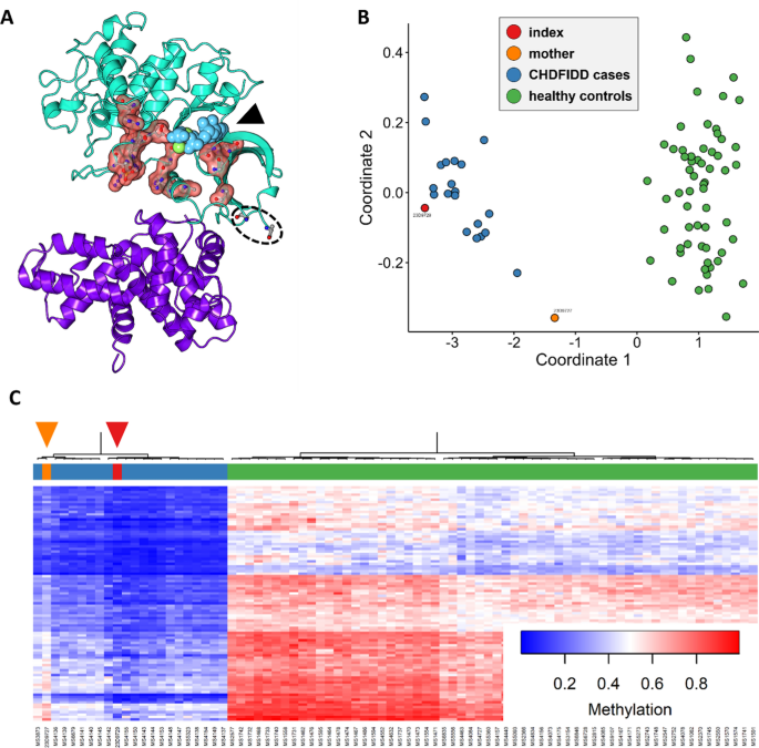 Validation of a hypomorphic variant in CDK13 as the cause of CHDFIDD ...
