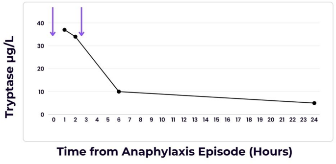 Transient refractory period in severe iodinated contrast media allergy ...