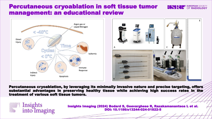 Percutaneous cryoablation in soft tissue tumor management: an ...