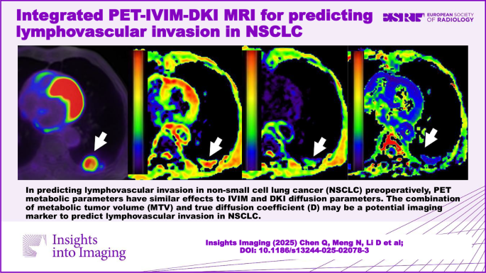 Integrated PET-IVIM-DKI MRI for predicting lymphovascular invasion in ...