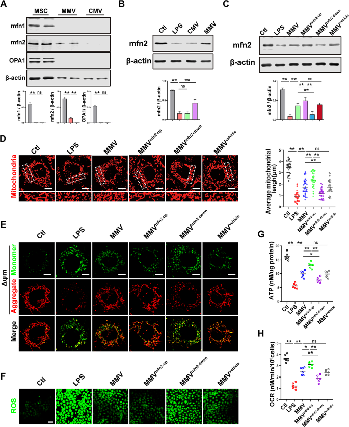 Correction: Mesenchymal stem cell-derived microvesicles improve ...