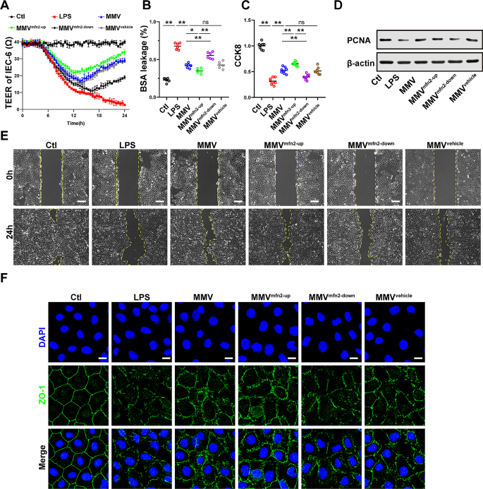 Correction: Mesenchymal stem cell-derived microvesicles improve ...