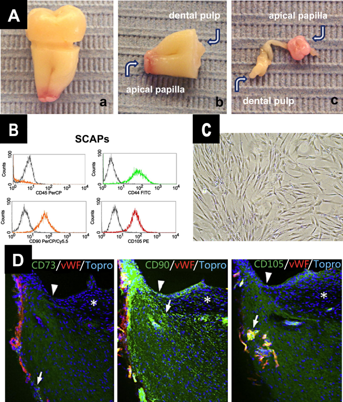 Exploring the potential of stem cells from the apical papilla (SCAPs ...
