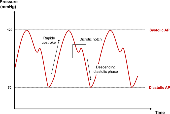 Applied physiology at the bedside: using invasive blood pressure as a ...