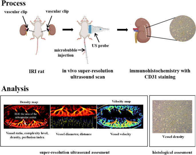Ultrasound super-resolution microvascular imaging of kidney ...