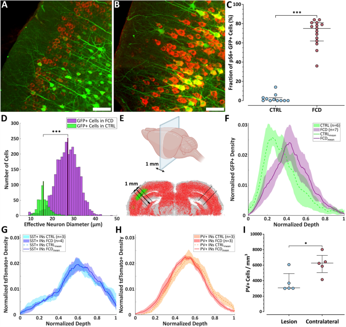 Seizure occurrence in FCD type II is predicted by lesion position and ...