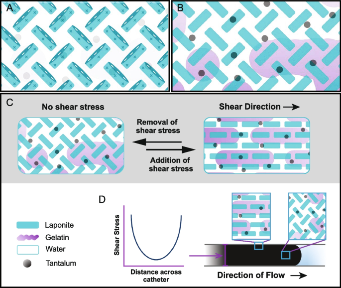 Real-world clinical experience with Obsidio Conformable Embolic | CVIR ...