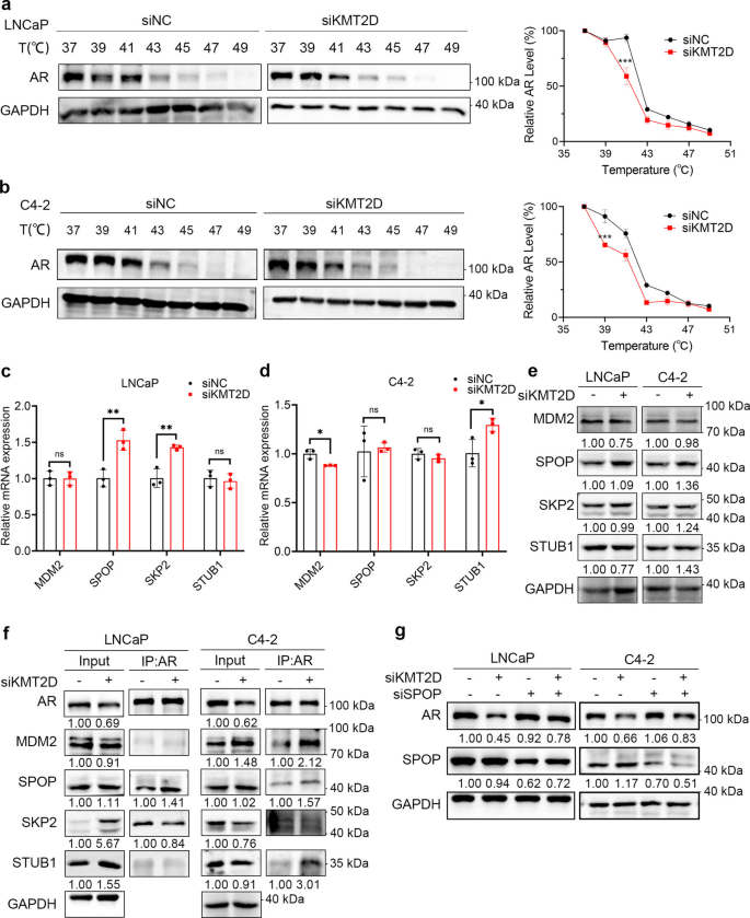 Histone methyltransferase KMT2D targets the SPOP-G3BP1 axis to enhance ...