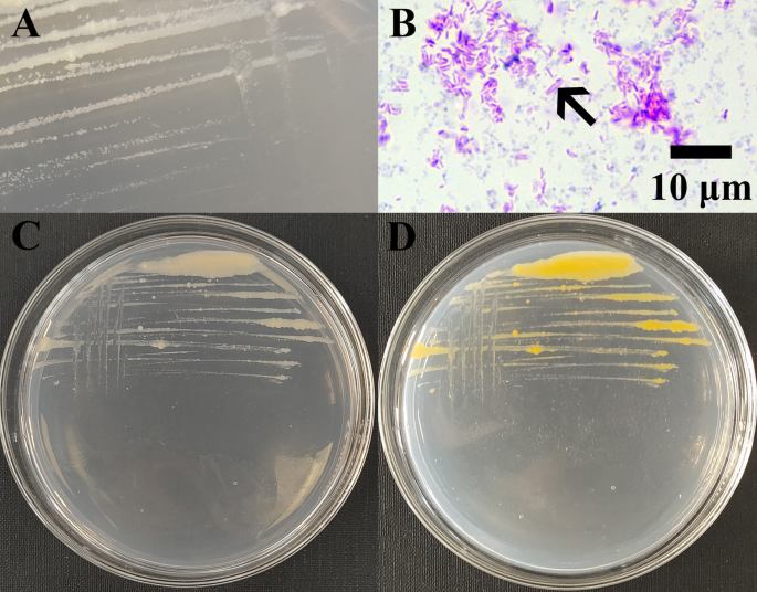 Mycobacteriosis caused by Mycobacterium marinum in Pterophyllum scalare ...
