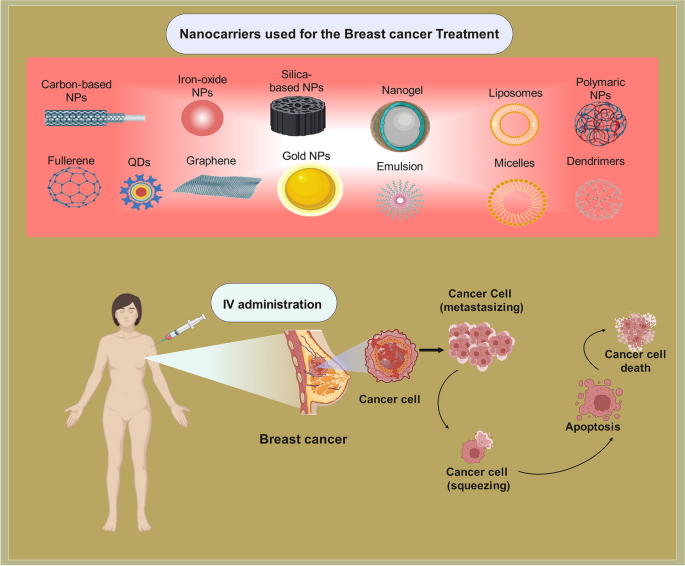 Recent Update on Nanocarrier(s) as the Targeted Therapy for Breast Cancer | AAPS PharmSciTech