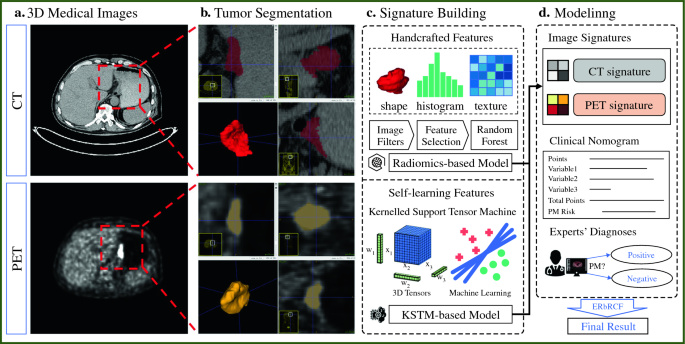 18F-FDG PET/CT Radiomics-Based Multimodality Fusion Model for ...