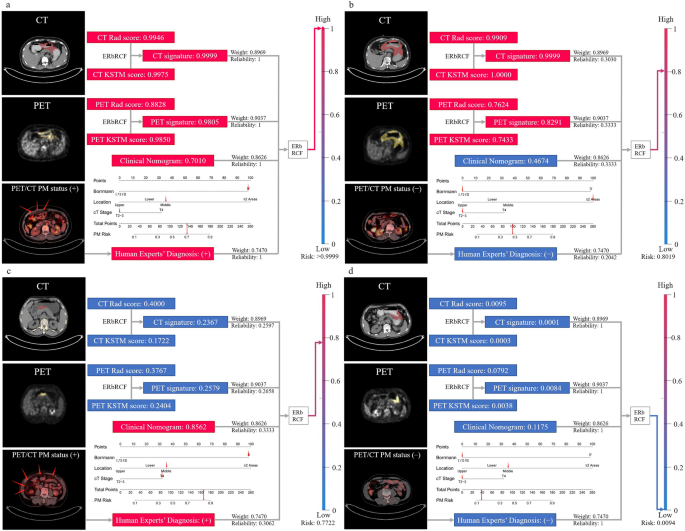 18F-FDG PET/CT Radiomics-Based Multimodality Fusion Model for ...