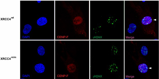 A nonsense mutation of human XRCC4 is associated with adult‐onset ...