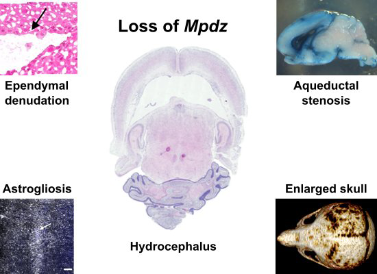 Loss of Mpdz impairs ependymal cell integrity leading to perinatal ...