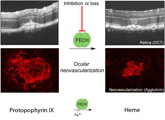 Ferrochelatase is a therapeutic target for ocular neovascularization ...