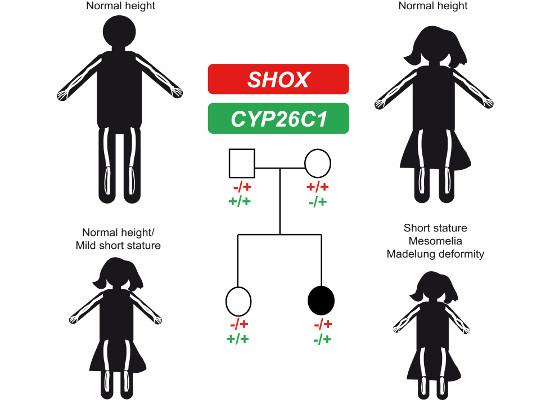 Retinoic acid catabolizing enzyme CYP26C1 is a genetic modifier in SHOX ...