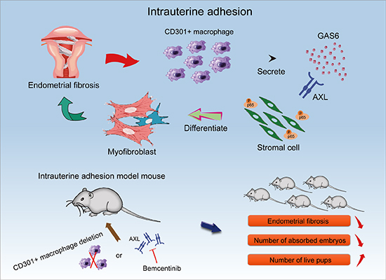 Targeting CD301+ macrophages inhibits endometrial fibrosis and improves ...