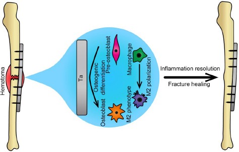 Research and clinical applications of selective laser melting tantalum ...