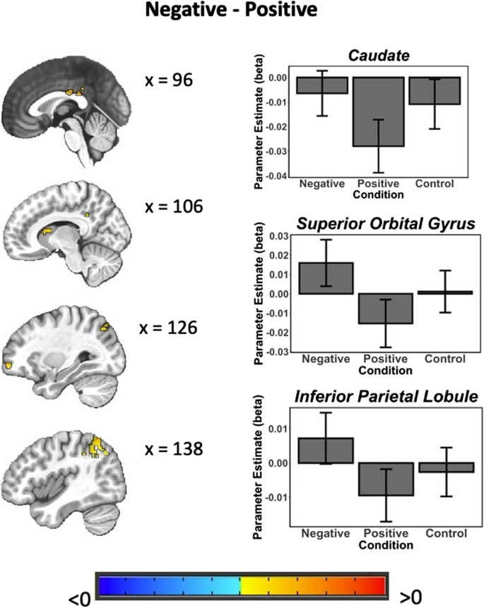 Affective music during episodic memory recollection modulates ...