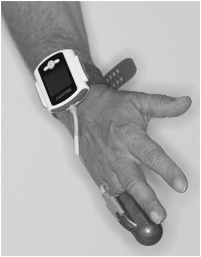 Home sleep apnea testing with peripheral arterial tonometry to assess ...