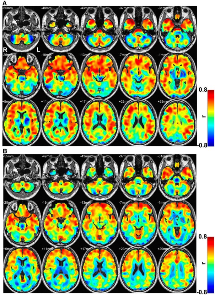 Relationships between brain tissue damage, oxygen desaturation, and ...