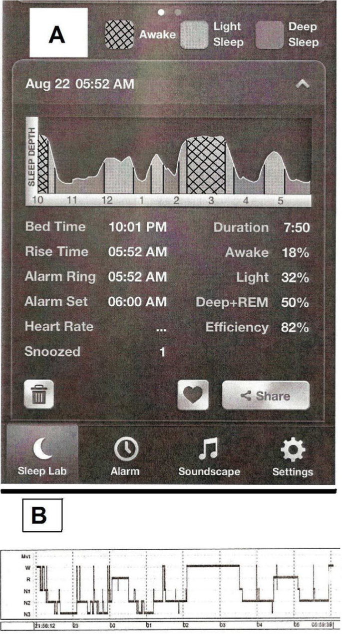 Is There a Clinical Role For Smartphone Sleep Apps? Comparison of Sleep ...
