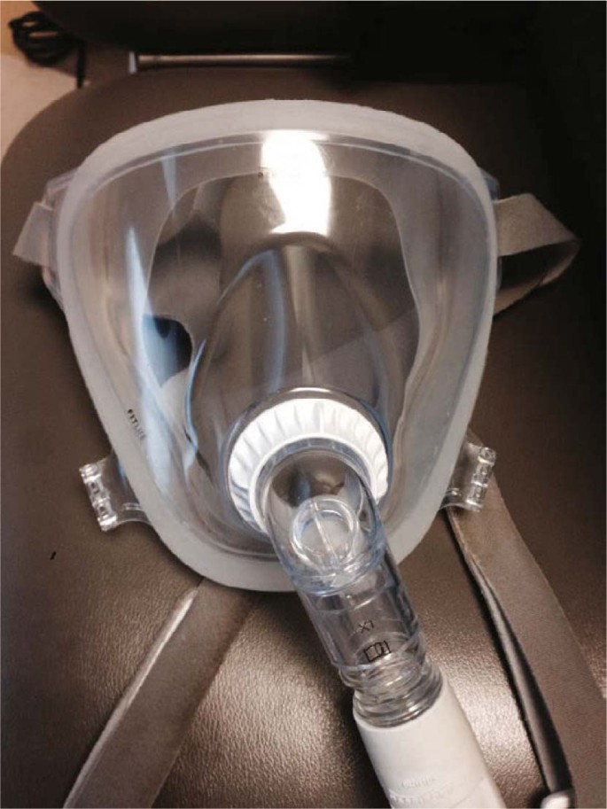 A Novel Treatment for Nasolacrimal Air Regurgitation Into the Eye With ...