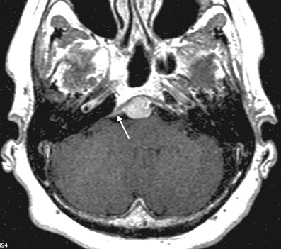 The Clivus | SpringerLink