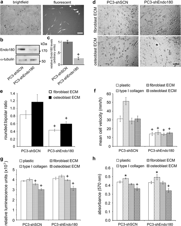 Tumor-associated Endo180 requires stromal-derived LOX to promote ...