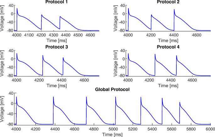 Complexity reduction in human atrial modeling using extended Kalman ...
