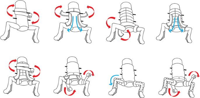 Comparing the mechanical strength of hip spica cast between a ...