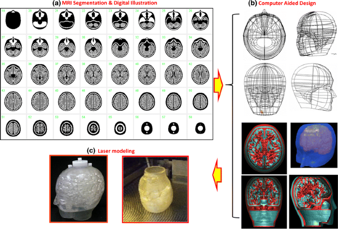 Three-dimensional brain phantom containing bone and grey matter ...